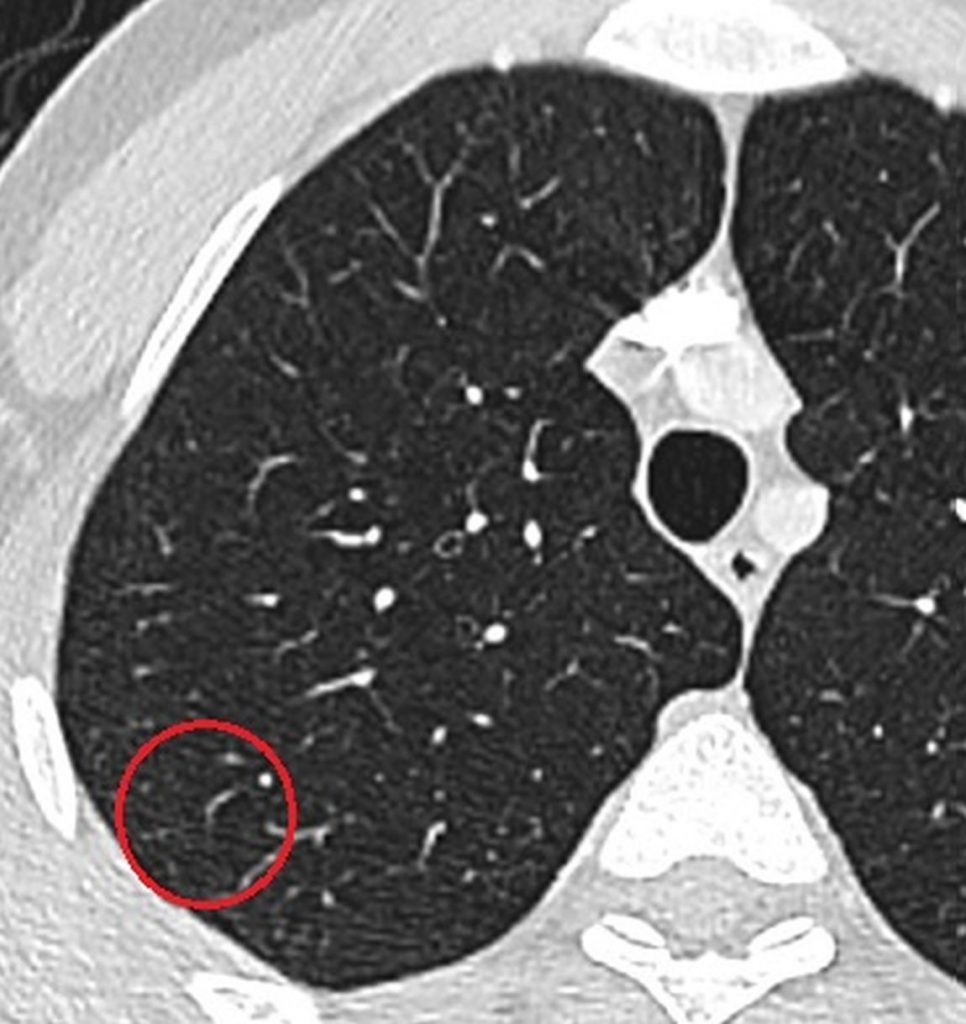 IDCM — Infectious Diseases and Clinical Microbiology
