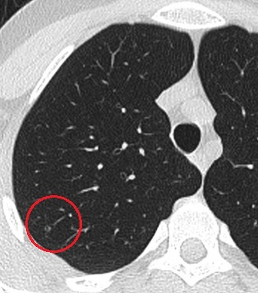 IDCM — Infectious Diseases and Clinical Microbiology