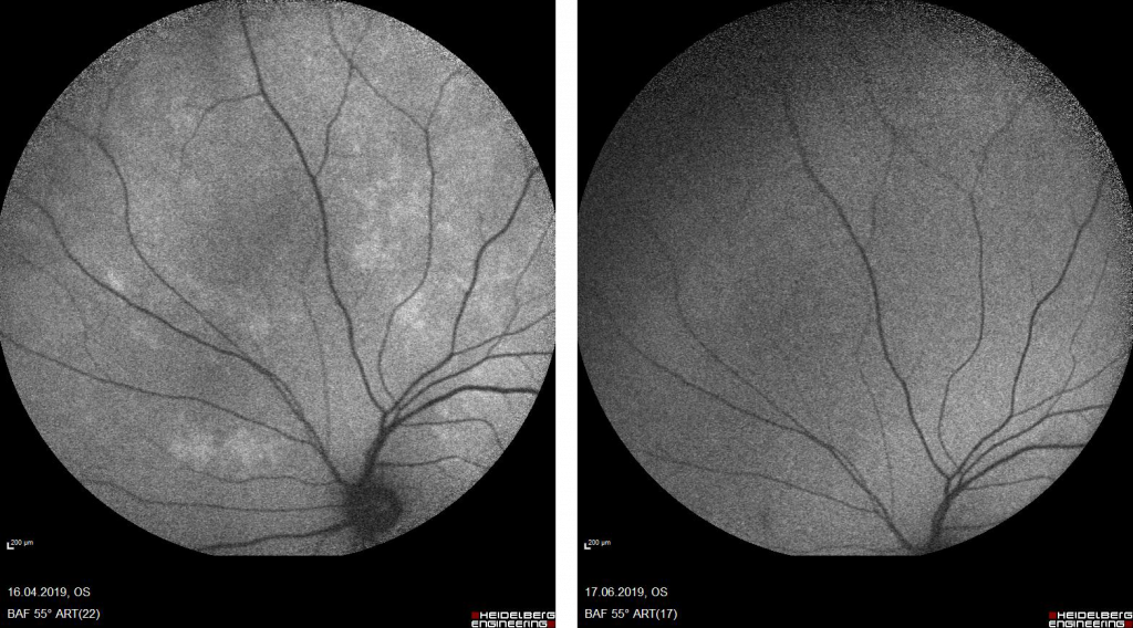 IDCM — Infectious Diseases and Clinical Microbiology