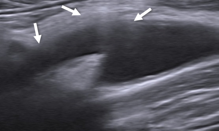 IDCM — Infectious Diseases and Clinical Microbiology