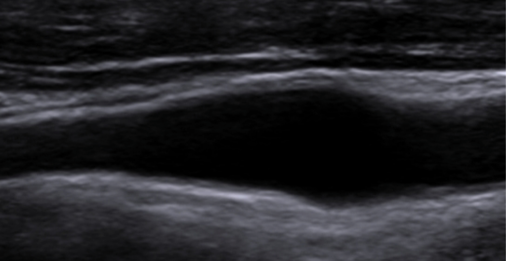 IDCM — Infectious Diseases and Clinical Microbiology