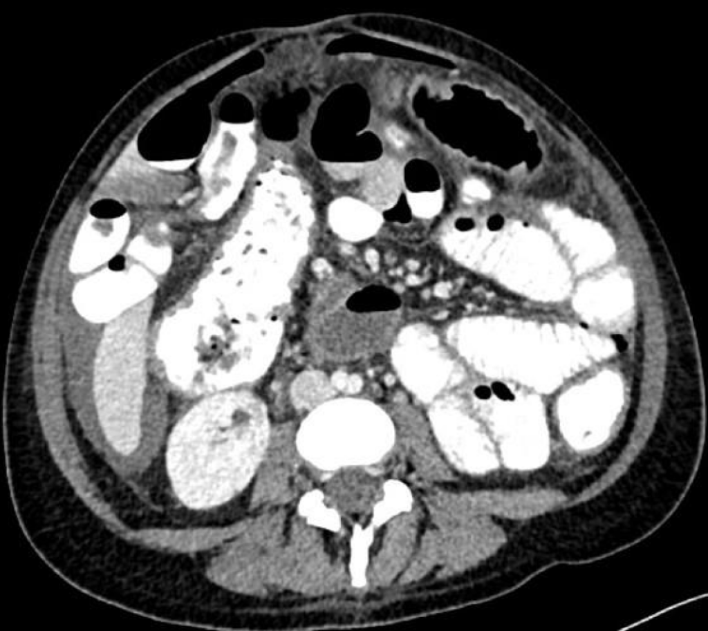 IDCM — Infectious Diseases and Clinical Microbiology