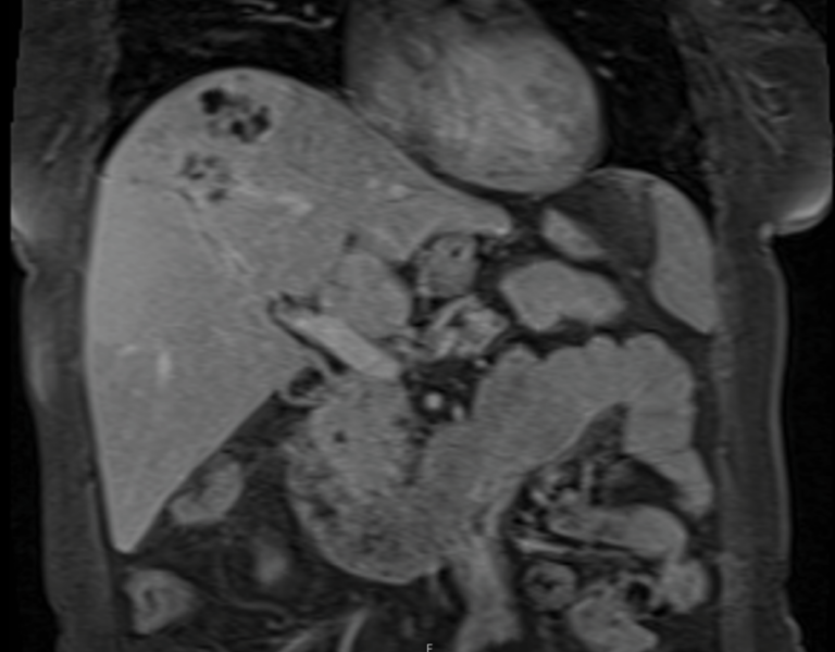 IDCM — Infectious Diseases and Clinical Microbiology