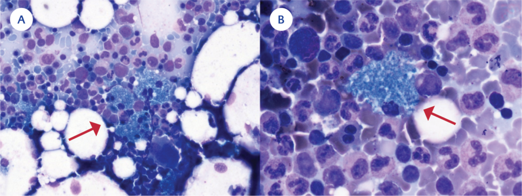 IDCM — Infectious Diseases and Clinical Microbiology